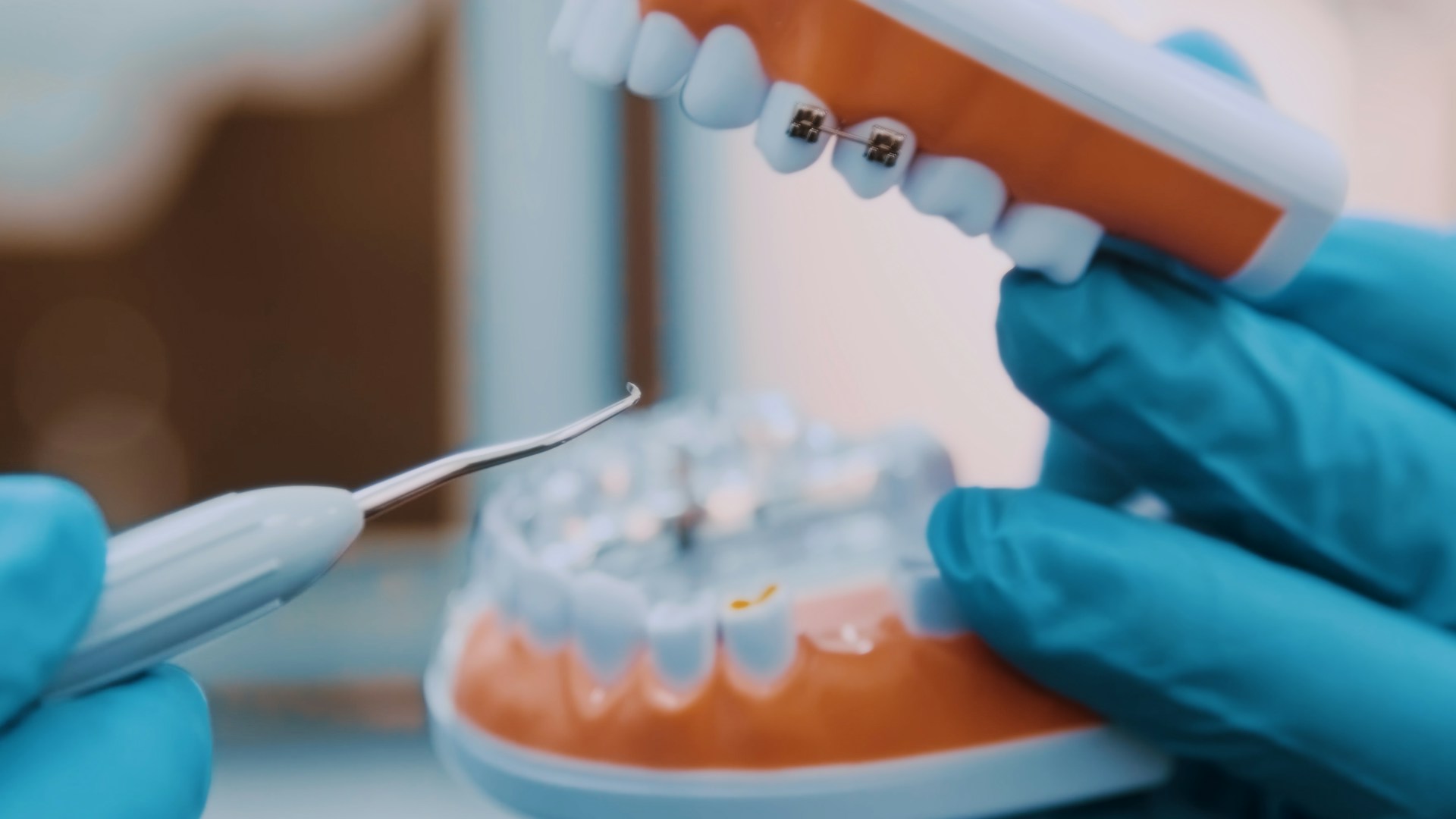 Professional vs At-Home Teeth Whitening Kits: Is the Price Difference ...
