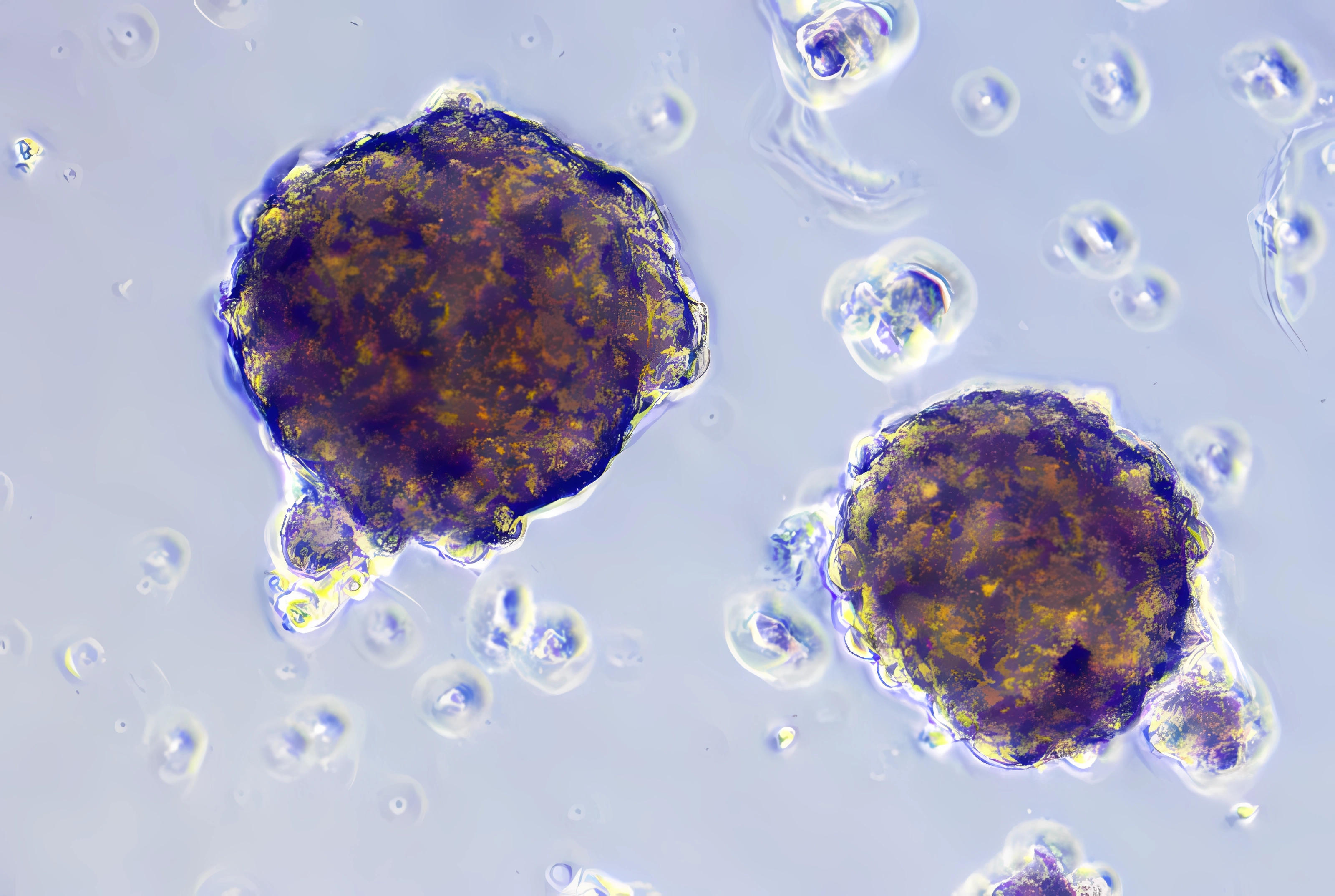 Cancer Cell DNA Doubling: Smaller Cells Drive Deadlier Tumors, Virginia ...