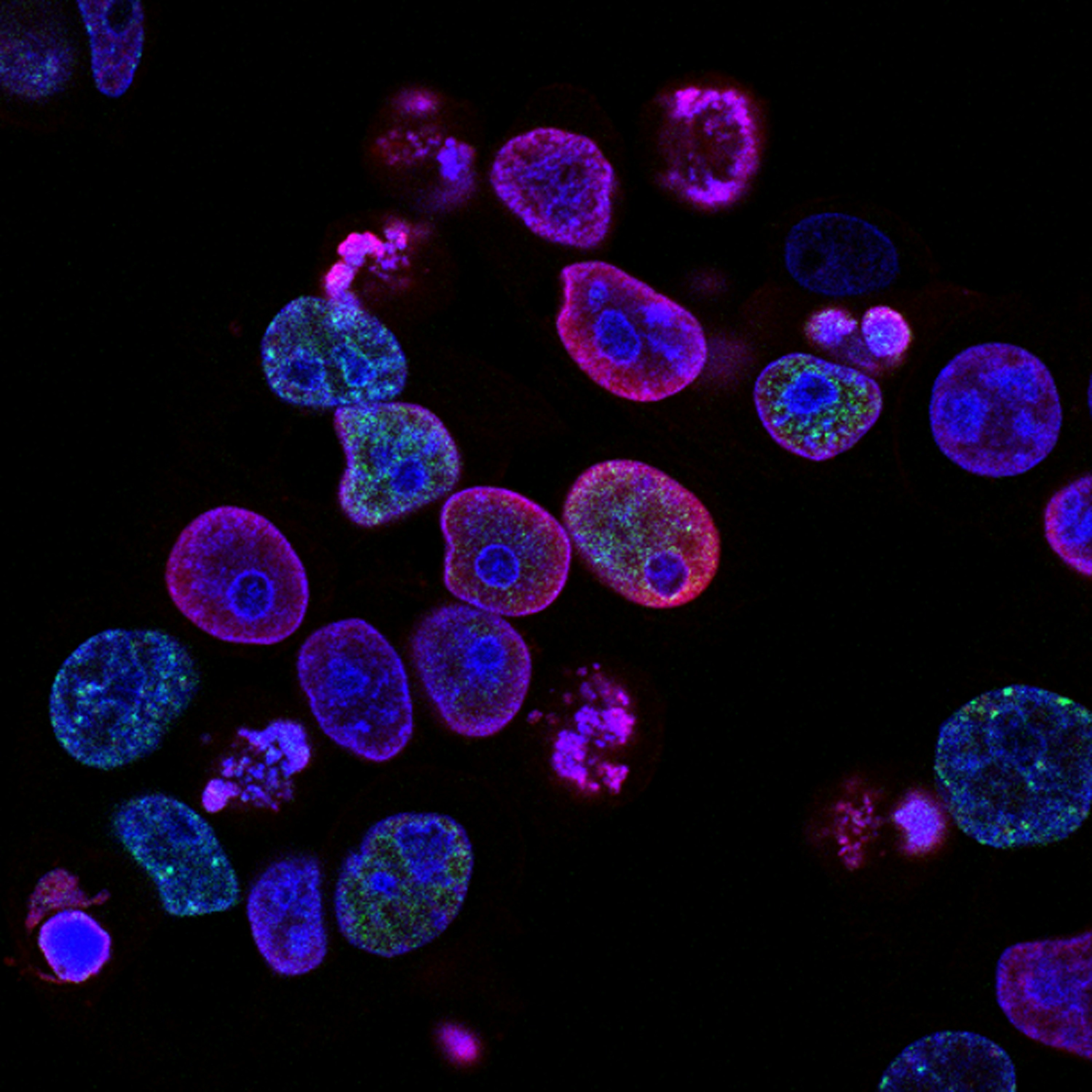 Colon Cancer Immunotherapy Wins FDA Priority Review: Tecentriq Cuts ...