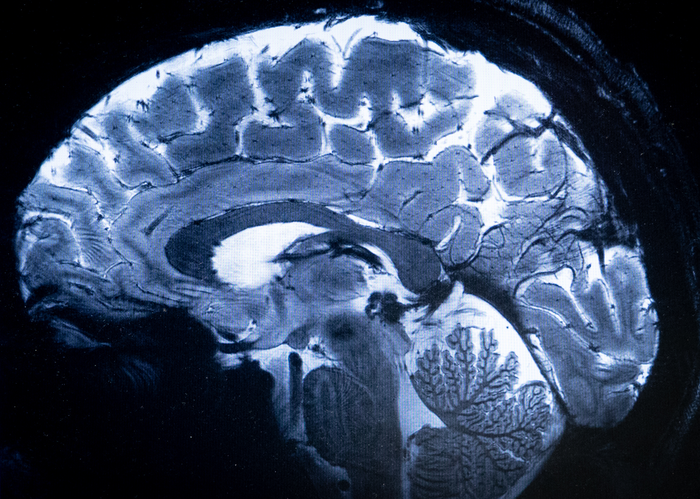 Brain Health Improves Into Your 90s: Two New Studies Overturn Aging Myth